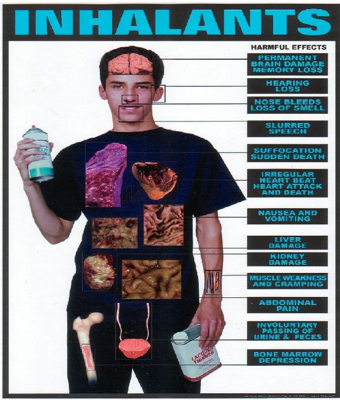 Inhalant Abuse Prevention La Dept Of Health Inhalant Abuse Prevention La Dept Of Health